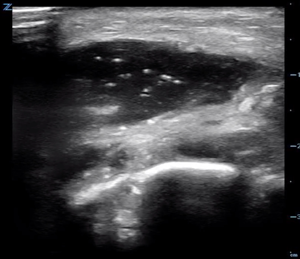 Alabama Chapter of the American College of Emergency Physicians