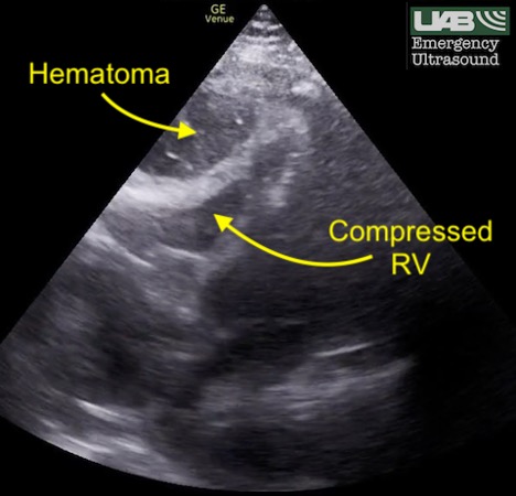 Alabama Chapter of the American College of Emergency Physicians